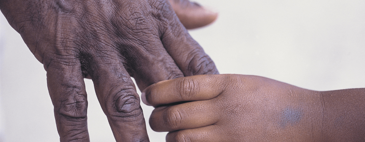 NAIDOC Week: Celebrating Indigenous Culture and Heritage – Yaye